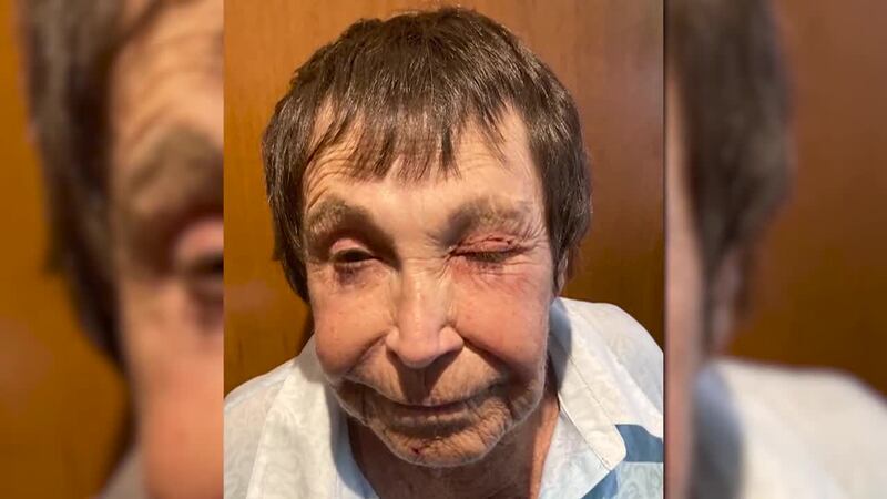 2 Year Old Dies After Shooting Himself In Head Police Say